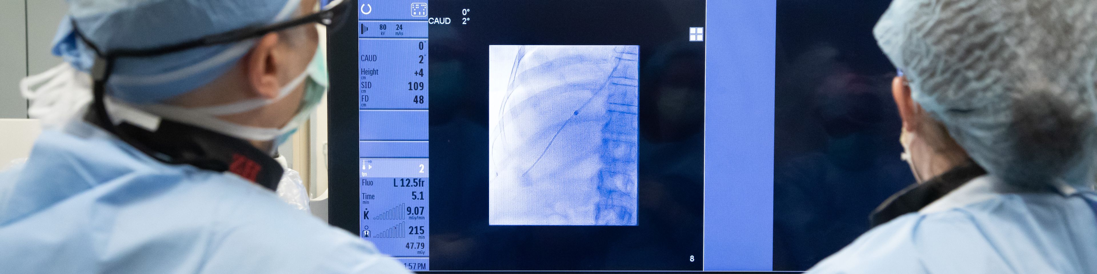 Uterine Fibroid Embolization | USA Health