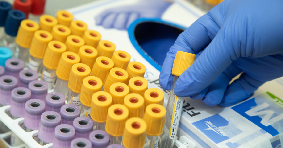 Diagnosing Prostate Cancer | USA Health