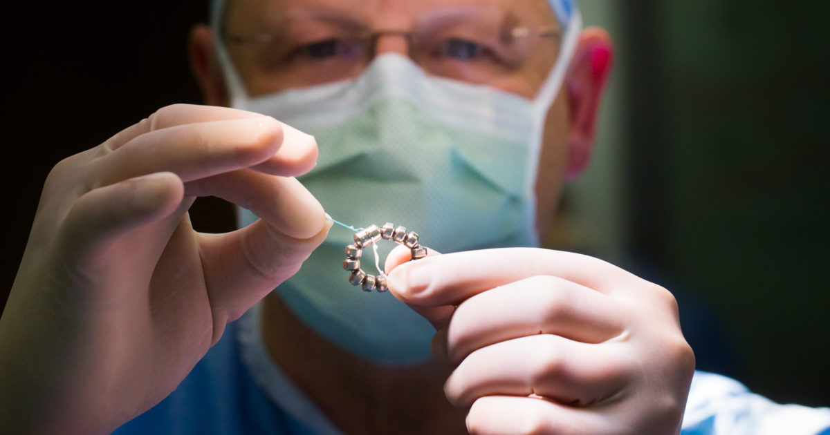 LINX study indicates procedure more effective treatment for GERD | USA ...