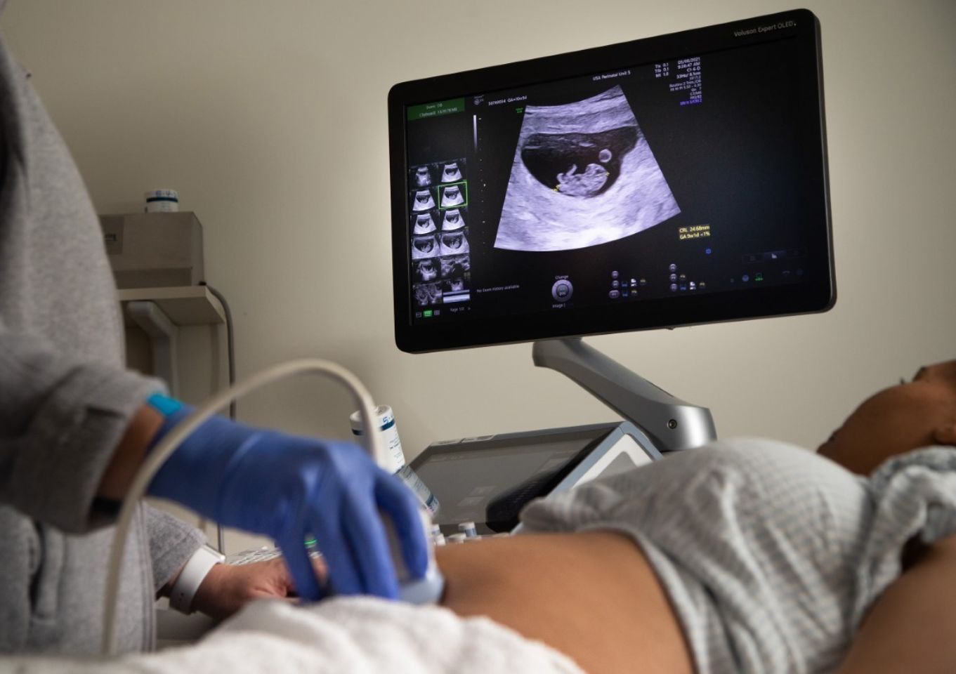 Susan L. Baker, M.D. | USA Health